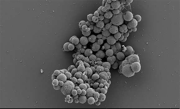 Dalhousie discovery unravels a mystery of viruses under the sea ...