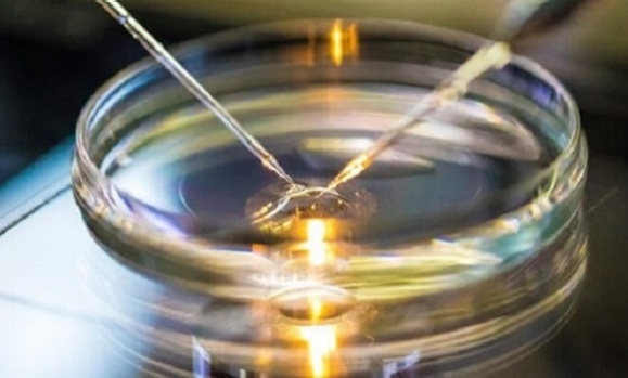 Human Embryo Research Beyond 14 Days? International Perspectives ...