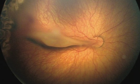 Pediatric Vision Science Research Group - Dalhousie University